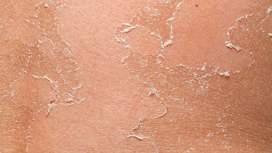 10 Weird Signs Your Body s Trying To Tell You Something EverTricks 10-weird-signs-your-body-s-trying-to-tell-you-something-evertricks